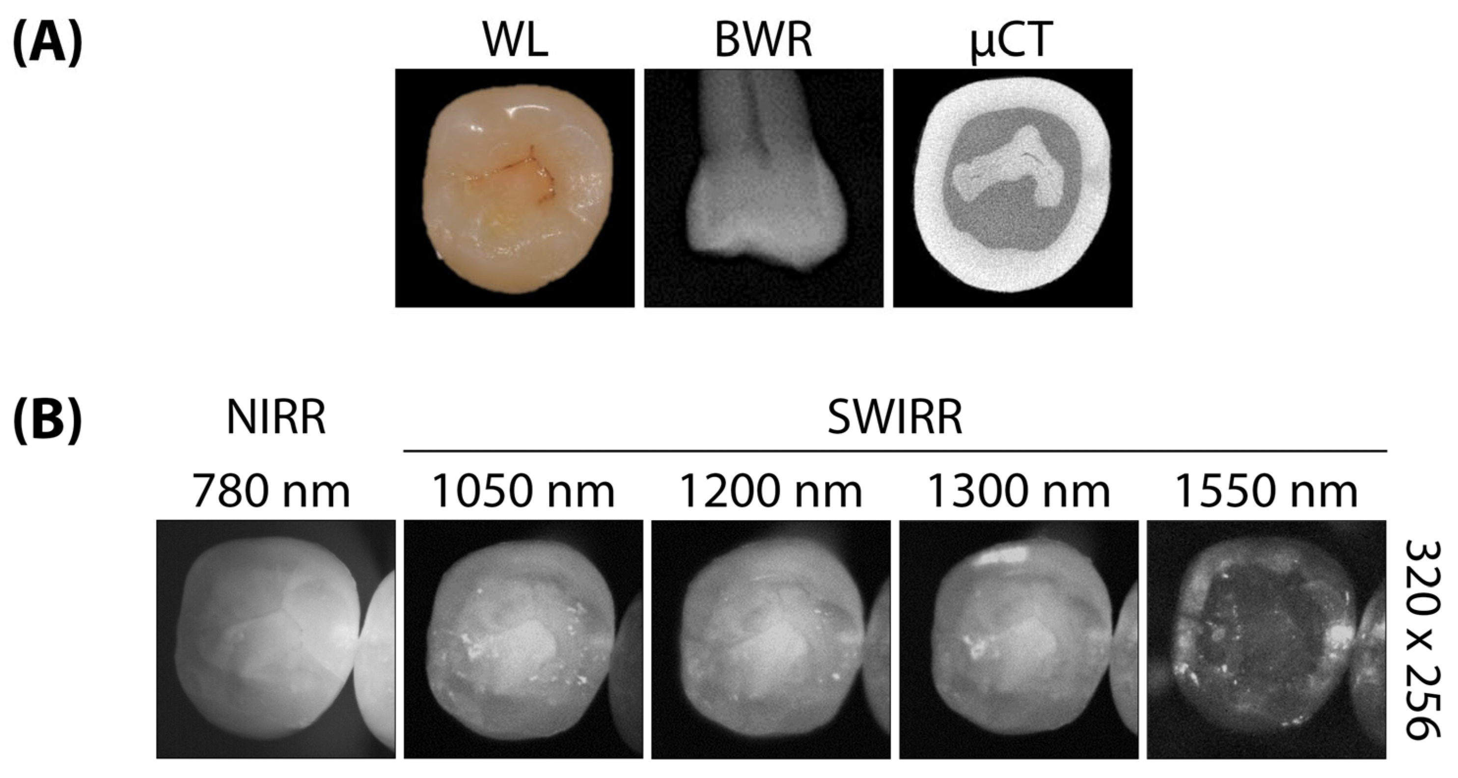 Short-Wave Infrared Reflectance at 1050–1550 nm for Proximal Caries ...