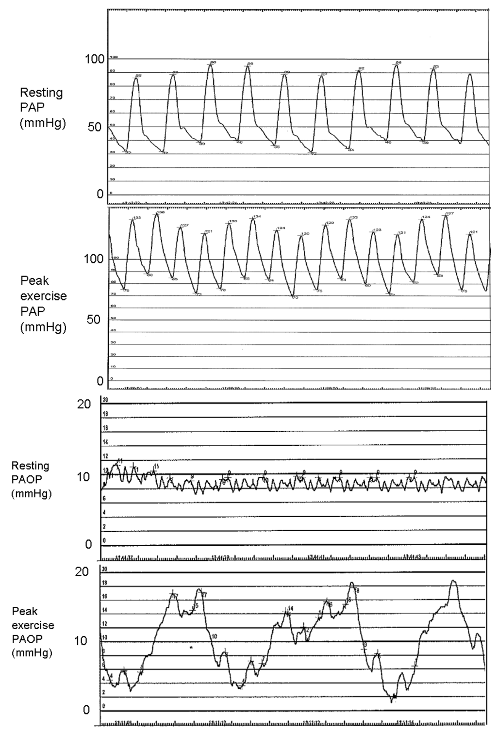 Diseases | Free Full-Text | The Role of Exercise Testing in the Modern ...