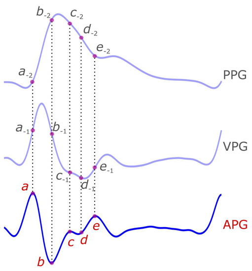 Toward Generating More Diagnostic Features from Photoplethysmogram ...