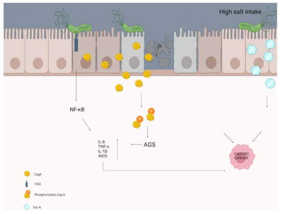 Overview of Helicobacter pylori Infection: Clinical Features, Treatment ...