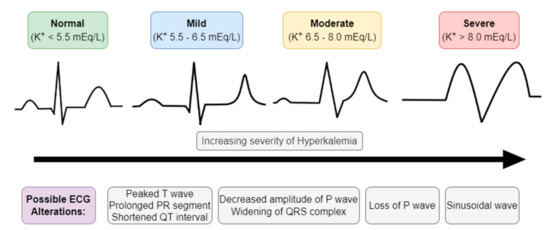 Hyperkalemia in Diabetes Mellitus Setting