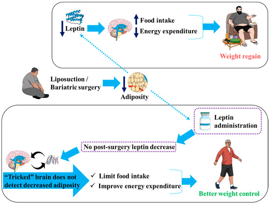 Diseases | Free Full-Text | Tricking the Brain with Leptin to Limit ...