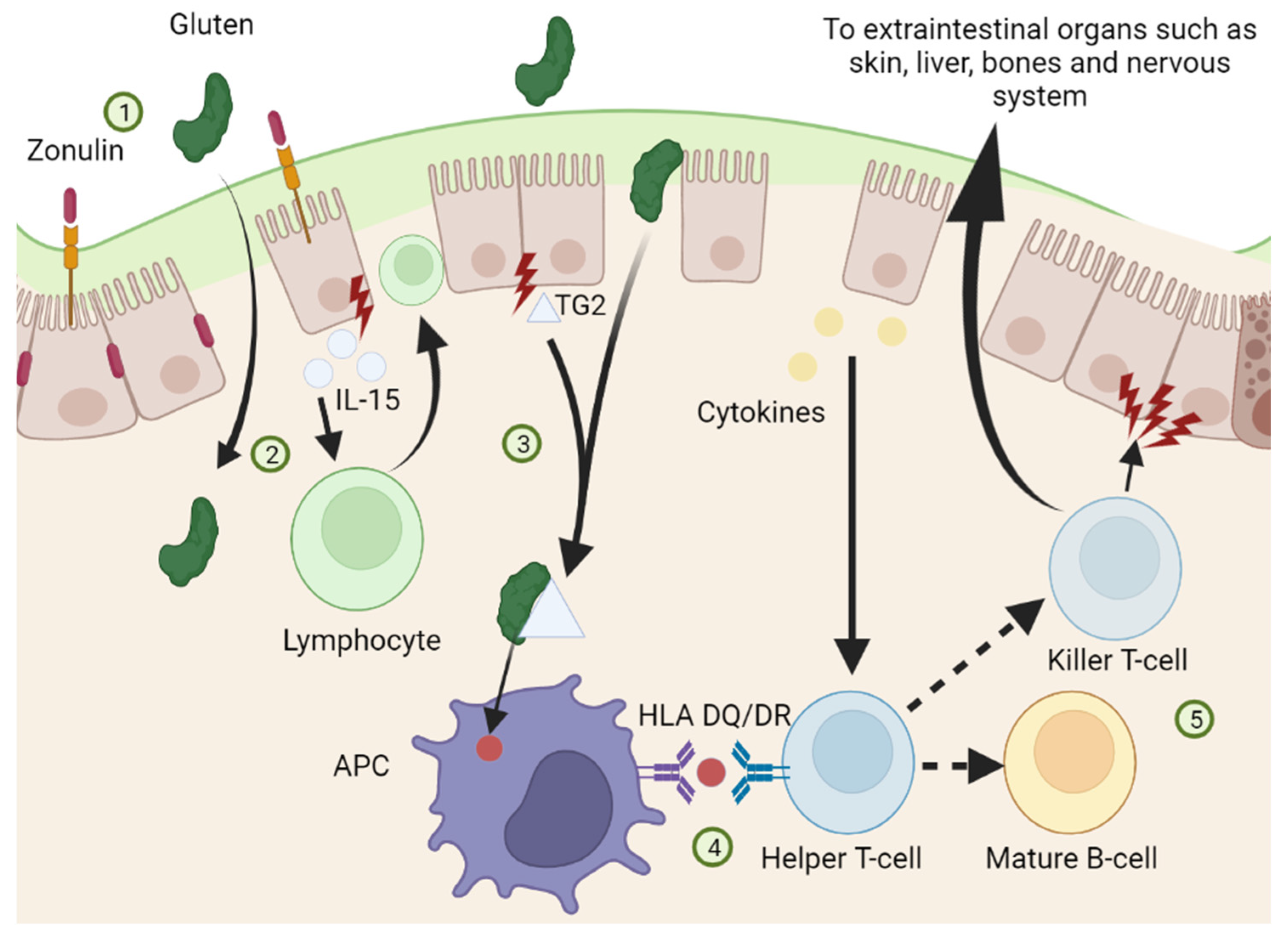 A Comprehensive Review of the Neurological Manifestations of Celiac ...