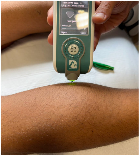 Is There a New Road to Spinal Cord Injury Rehabilitation? A Case Report ...