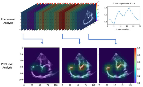 Automated Atrial Fibrillation Diagnosis by Echocardiography without ECG: Accuracy and ...