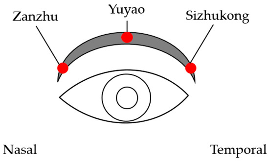 Effectiveness of an Acupuncture Steam-Warming Eye Mask on Dry Eye ...