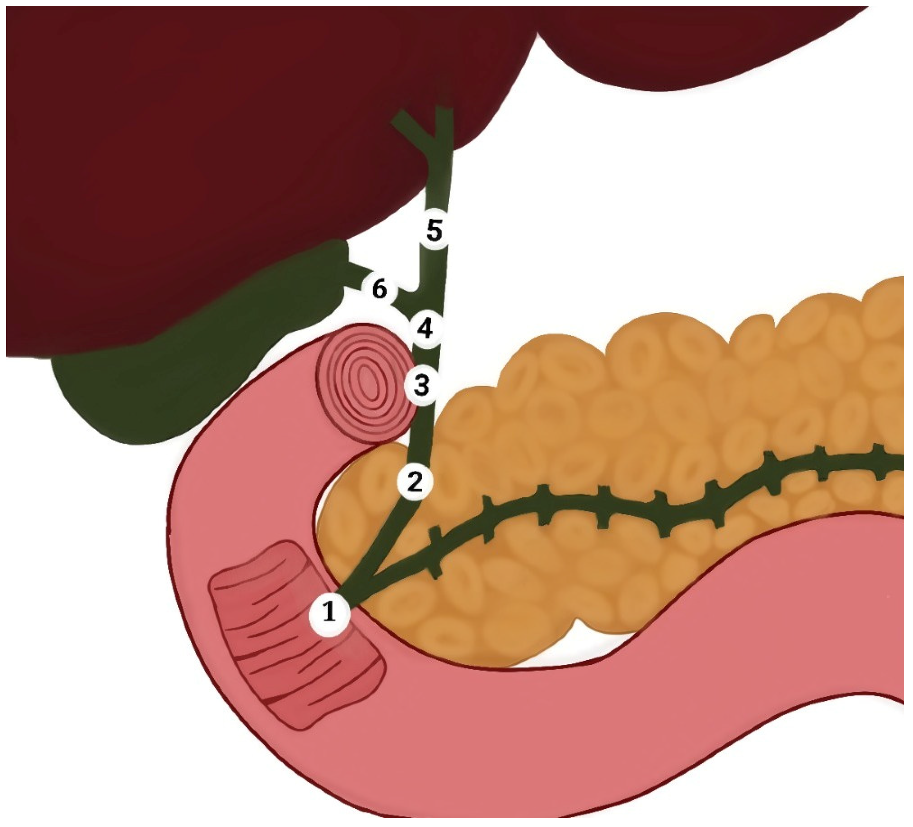 Demographic Profiles, Etiological Spectrum, and Anatomical Locations of the Post-Hepatic ...