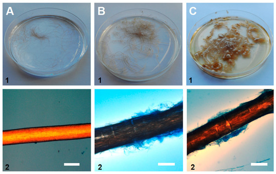 First Report on the Occurence of Dermatophytes of Microsporum Cookei ...