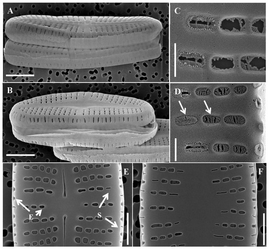 Two New Benthic Diatoms of the Genus Achnanthidium (Bacillariophyceae ...