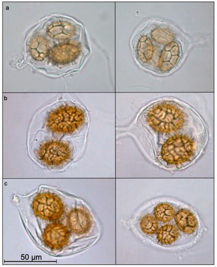 Tuber mesentericum and Tuber aestivum Truffles: New Insights Based on ...