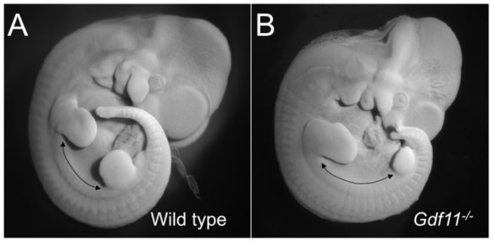 Of Necks, Trunks and Tails: Axial Skeletal Diversity among Vertebrates