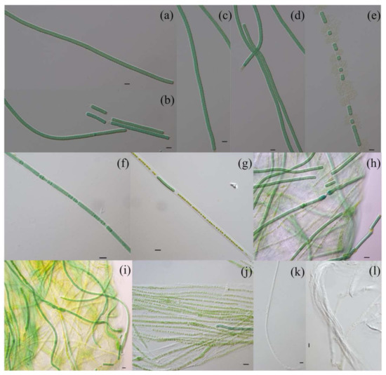 Oscillatoria Under Microscope 100x
