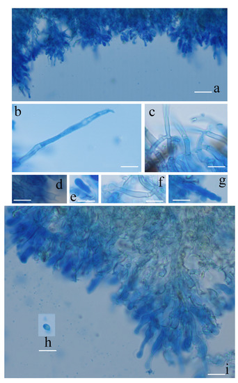 Additions to the Knowledge of Corticioid Xylodon (Schizoporaceae ...