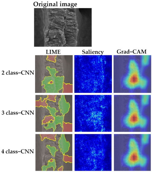 Diversity | Free Full-Text | Deep Learning Applied to SEM Images for Supporting Marine Coralline ...