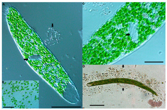 A Case Building Ciliate in the Genus Pseudoblepharisma Found in ...