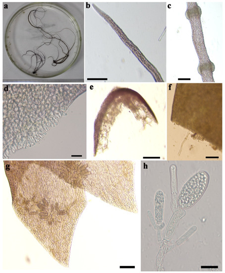 Morphological and Molecular Phylogenetic Analysis of a Lemanea Specimen ...