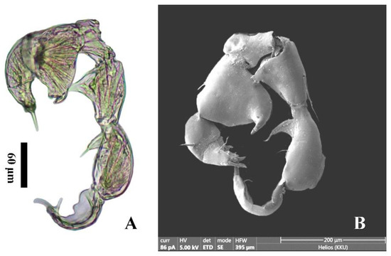 Diversity of Freshwater Calanoid Copepods (Crustacea: Copepoda ...