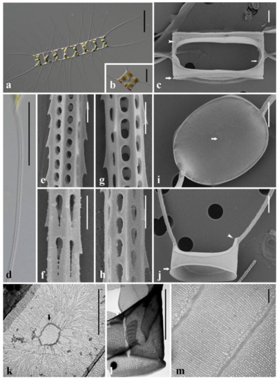 Semicryptic Diversity around Chaetoceros elegans (Bacillariophyta ...