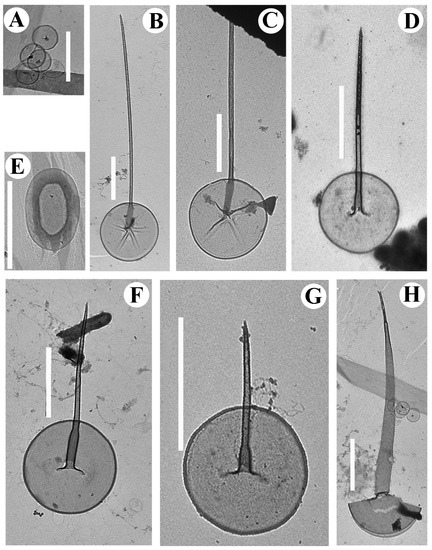 Diversity of Silica-Scaled Chrysophytes (Stramenopiles: Chrysophyceae ...