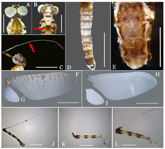 The Real Characters of Heptagenia ngi Hsu (1936) from China ...