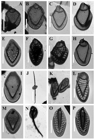 Silica-Scaled Chrysophytes of Teletskoye Lake and Adjacent Area with a ...