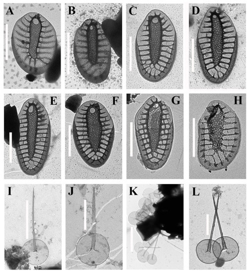 Silica-Scaled Chrysophytes of Teletskoye Lake and Adjacent Area with a ...