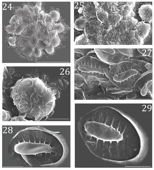 Morphological and Molecular Characterizations of Three Species of the Genus Synura (Synurales ...