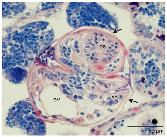 No Tail No Fail: Life Cycles of the Zoogonidae (Digenea)