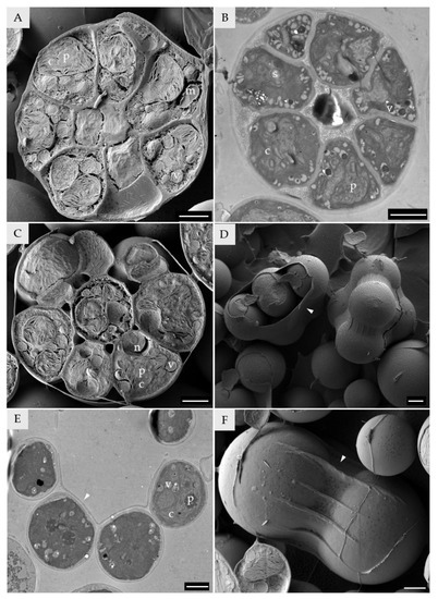 Low Temperature Scanning Electron Microscopy (LTSEM) Findings on the ...
