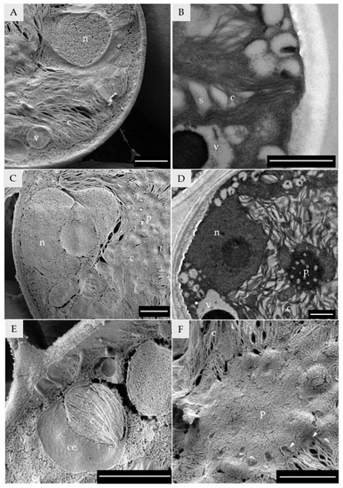 Low Temperature Scanning Electron Microscopy (LTSEM) Findings on the ...