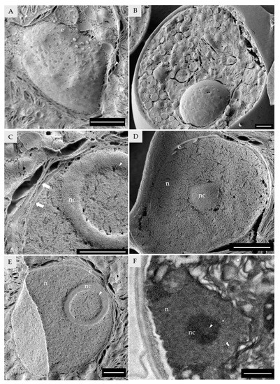 Low Temperature Scanning Electron Microscopy (LTSEM) Findings on the ...