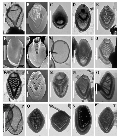 An Annotated Checklist of Algae from the Order Synurales (Chrysophyceae ...