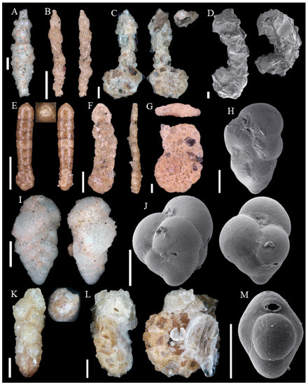 Benthic Foraminifera Diversity of the Abyssal Northwest Atlantic