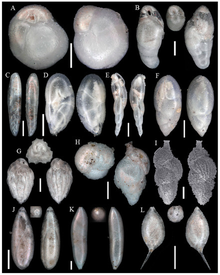 Benthic Foraminifera Diversity of the Abyssal Northwest Atlantic