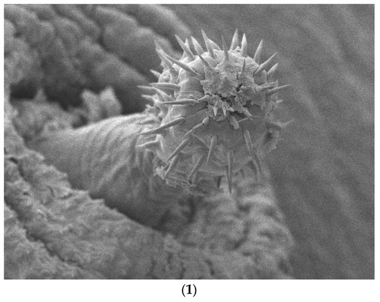 Occurrence of Gastrointestinal Parasites in Synanthropic Neozoan ...