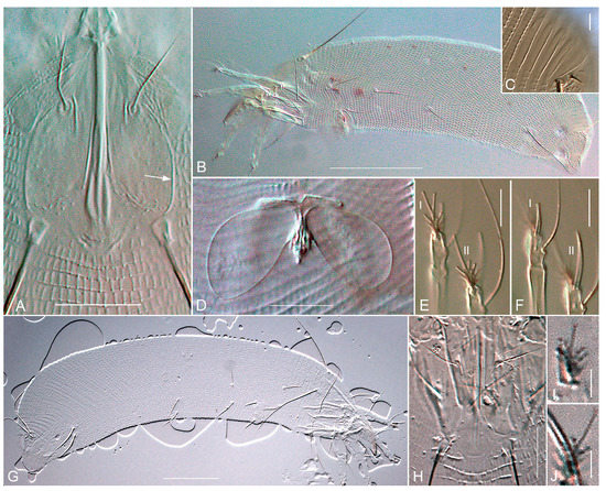 Endoparasitic Gall Mites: Two New Novophytoptus Species (Eriophyoidea ...