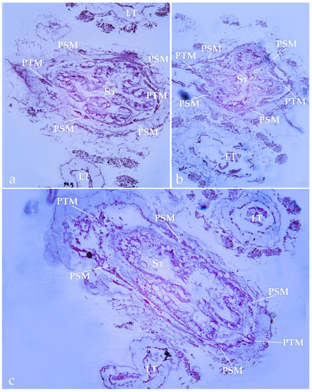 One of the Deepest Genera of Antipatharia: Taxonomic Position Revealed ...