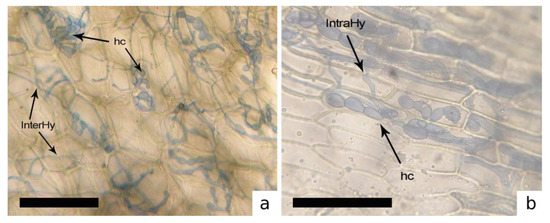 On the Occurrence of Arbuscular Mycorrhizal Fungi in a Bryophyte ...