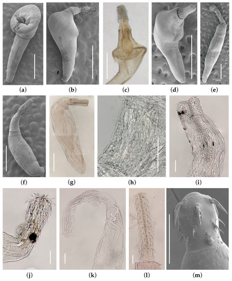 Acanthocephalan Diversity and Host Associations Revealed from a Large-Scale Biodiversity Survey