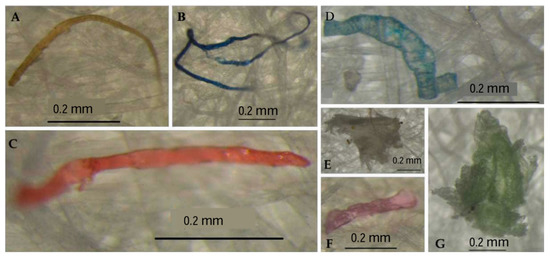 Microplastics Occurrence in Fish from Tocagua Lake, Low Basin Magdalena ...