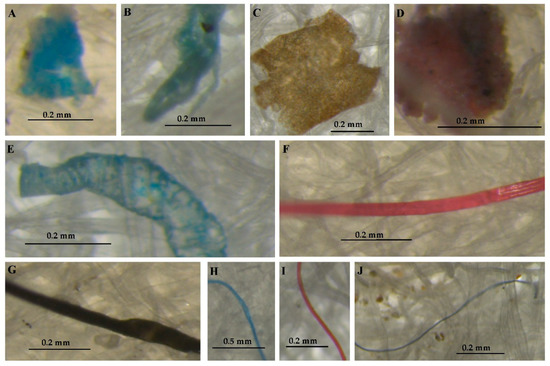 Microplastics Occurrence in Fish from Tocagua Lake, Low Basin Magdalena ...