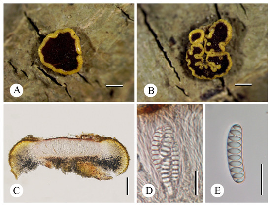 The Lichen Genus Letrouitia (Brigantiaeaceae, Ascomycota) in China