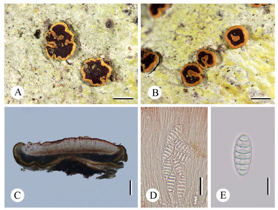 The Lichen Genus Letrouitia (Brigantiaeaceae, Ascomycota) in China