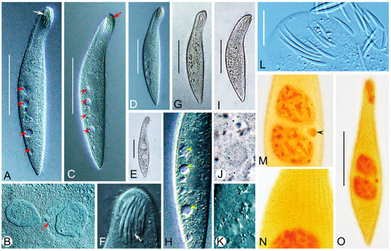 Diversity of Pleurostomatid Ciliates: Morphology, Taxonomy and ...