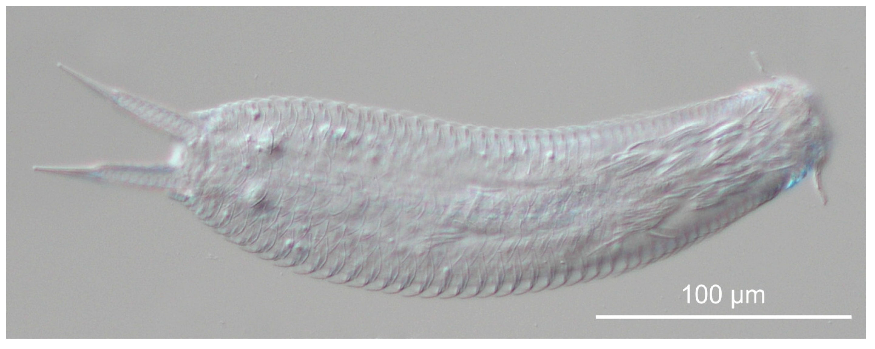 First Investigation of the Marine Gastrotrich Fauna from the Waters of ...