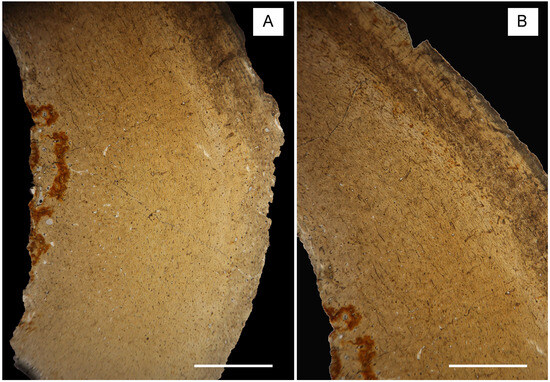 Paleohistological Analysis of “Terror Birds” (Phorusrhacidae ...
