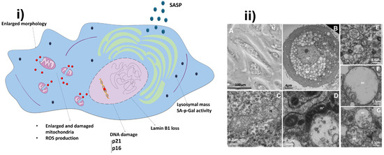 Cell Senescence and the DNA Single-Strand Break Damage Repair Pathway