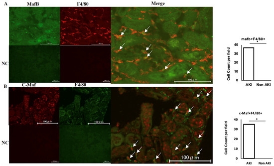 MafB Transcription Factor Involved in IRD-Induced AKI (Acute Kidney ...