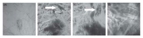Imaging Techniques Used for Wound Healing Assessment: A Systematic ...