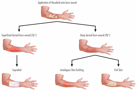 The Use of Intact Fish Skin as a Novel Treatment Method for Deep Dermal ...